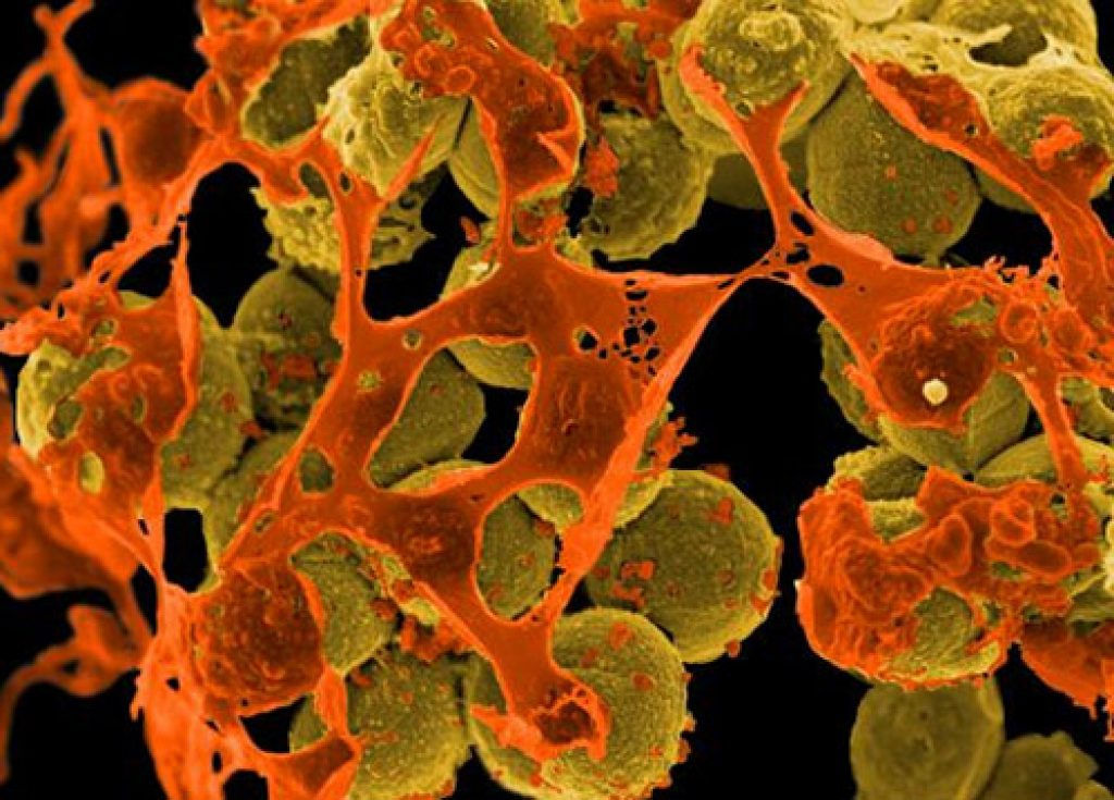 Scientists figured out how Golden Staph go Through the Immunity System ...