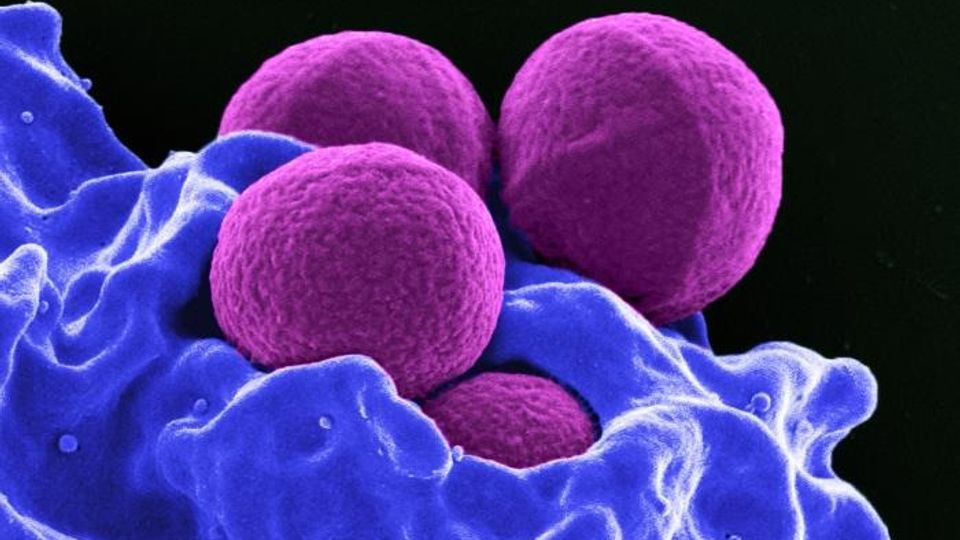 Scientists Reveal the Monster Inside Golden Staph - Letterly Journal